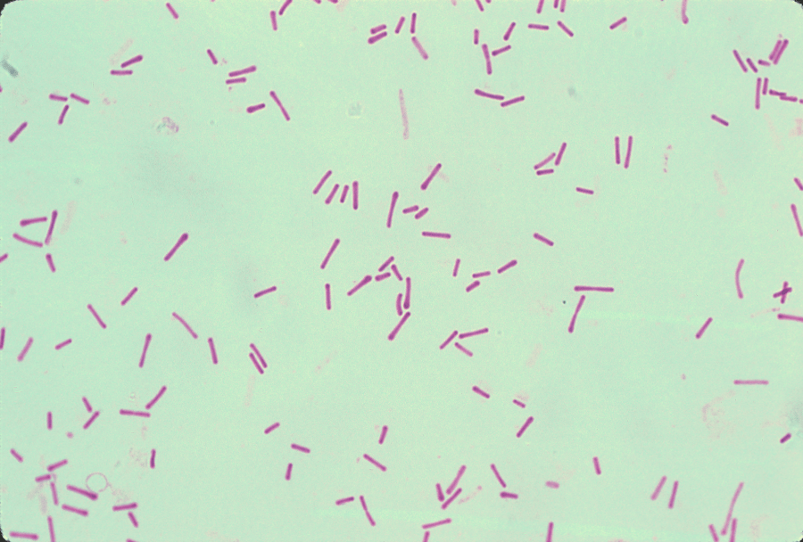 Stained smear – Footrot @ Sydney